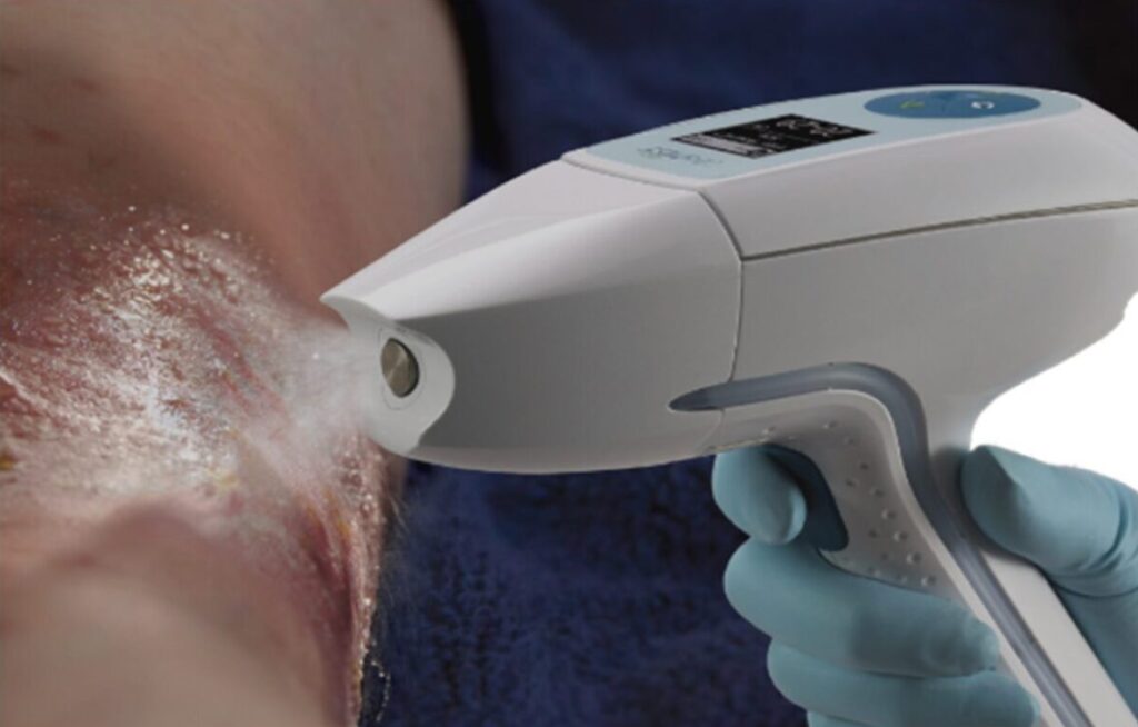 UltraMIST™ - Halo Biologics