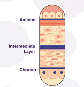 Amchoplast ™ - Halo Biologics
